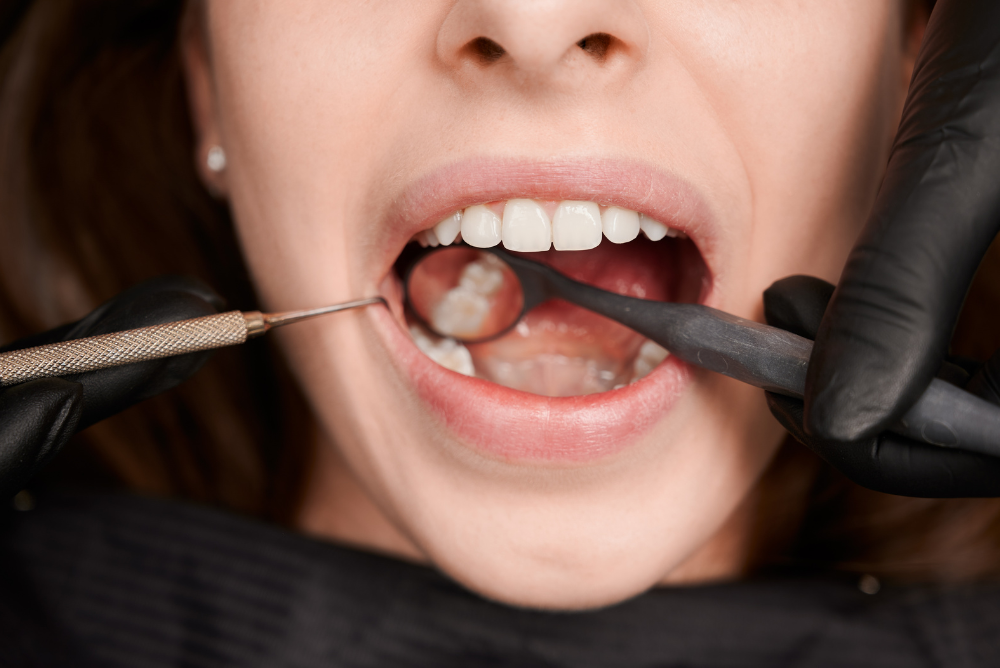 What is the Recovery Time After a Tooth Extraction?